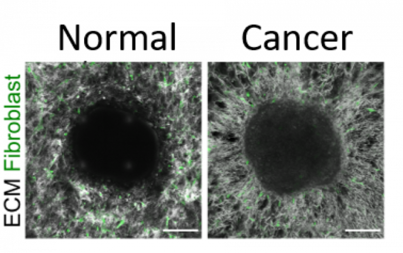 Stopping Cancer in its Tracks: Hopkins Researchers Investigate ...